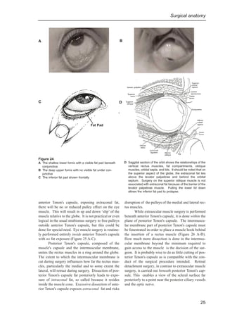 Strabismus Surgical Management of strabismus EHelveston.pdf