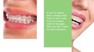 Straighten Your Teeth with Invisalign | PPT