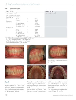 Straight_wire_appliances_standard_versus.pdf
