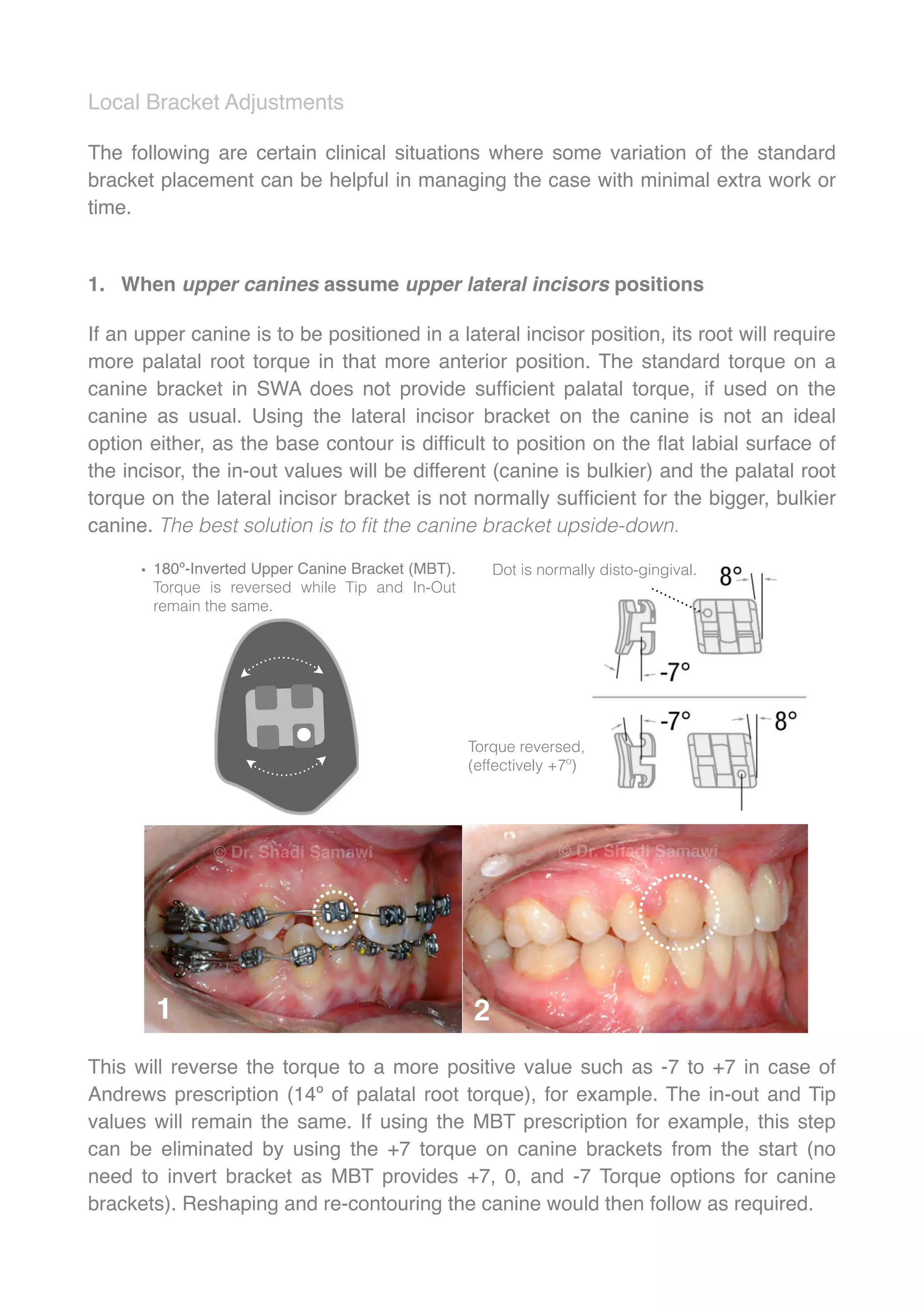 Straight-Wire Orthodontics (1st Edition) - 2014 - Shadi Samawi | PDF