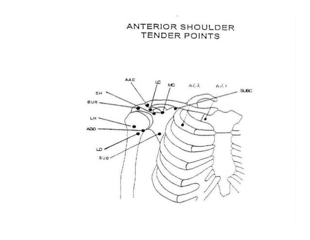 Strain counterstrain powerpoint
