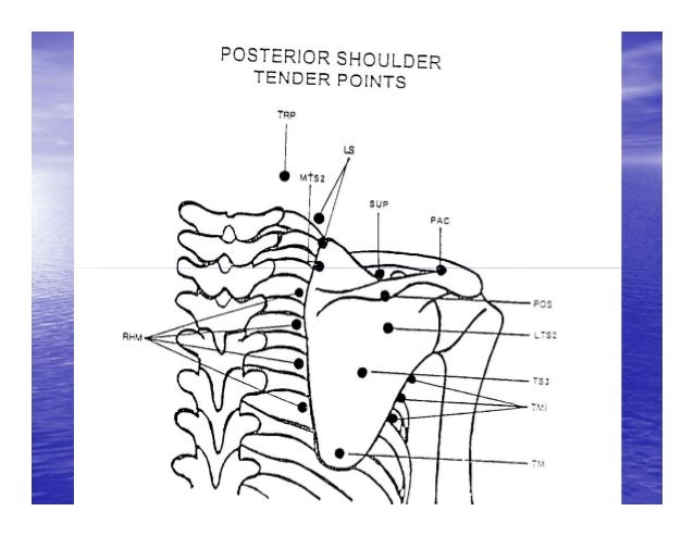 Strain counterstrain powerpoint