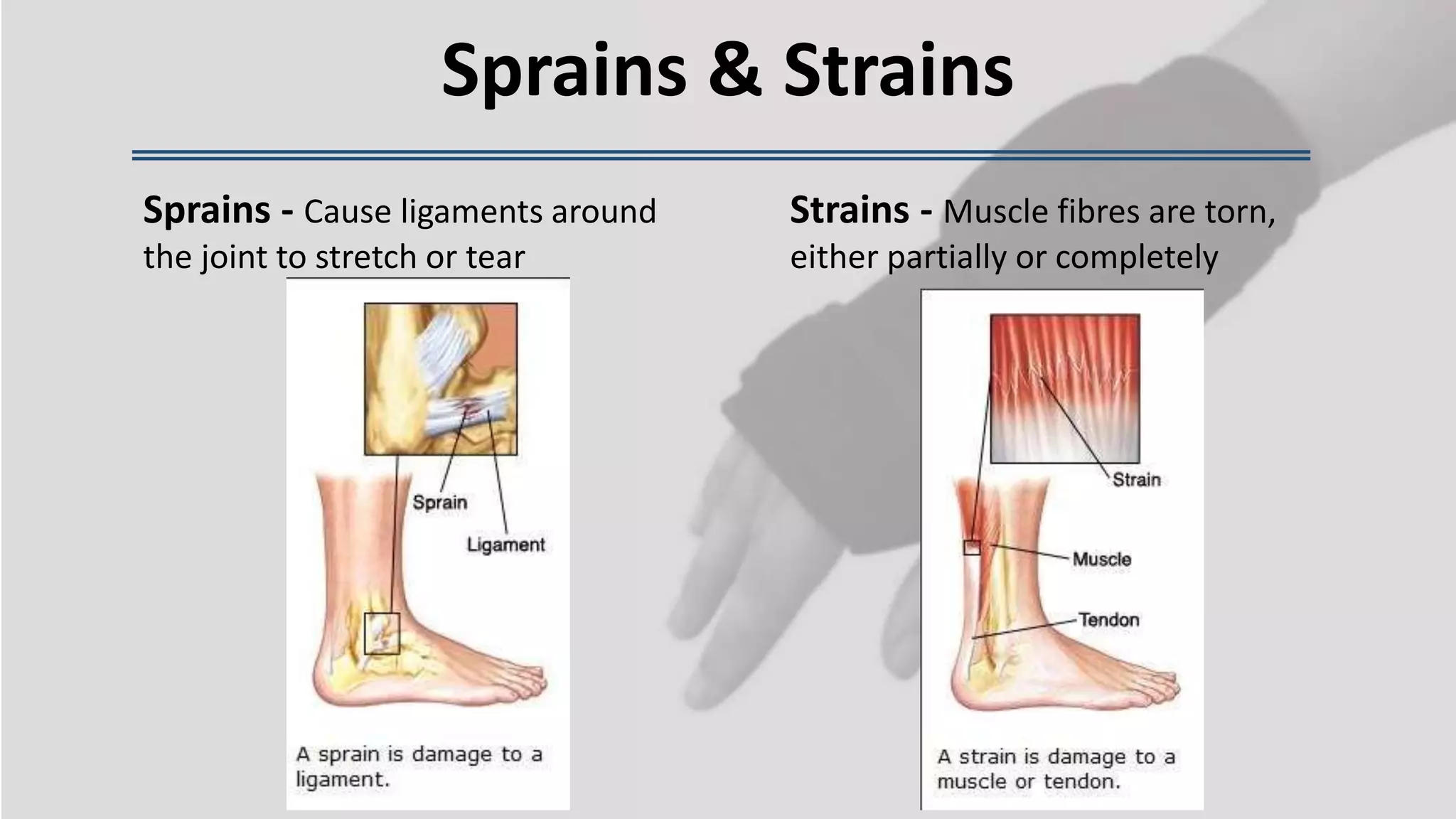 Strains & Sprains | PPTX
