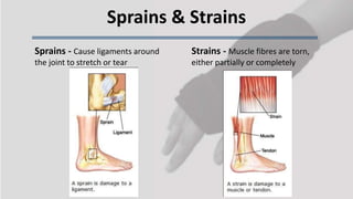 Strains & Sprains | PPTX