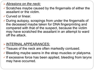Strangulation Forensic Medicine | PPTX