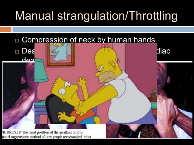 Strangulation | PPTX