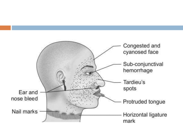 Strangulation | PPTX