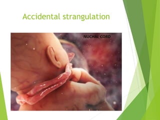 strangulation forensic medicine important.pptx