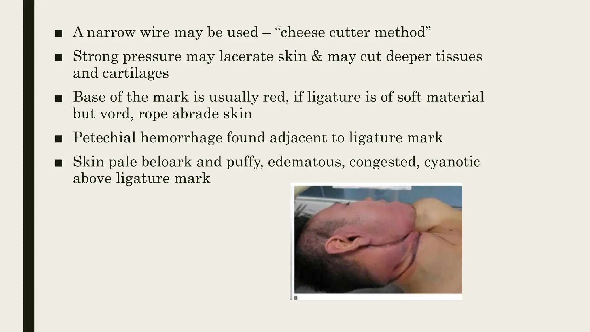 strangulation and other injuries inFmt.pptx