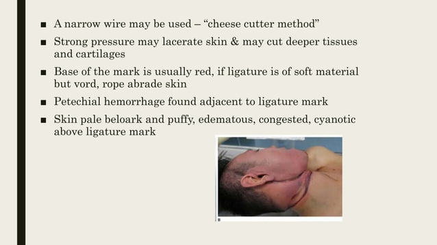 strangulation and other injuries inFmt.pptx | Thyroid Disorders ...