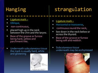 Strangulation a forensic view | PPT