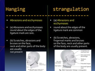 Manual Strangulation Marks
