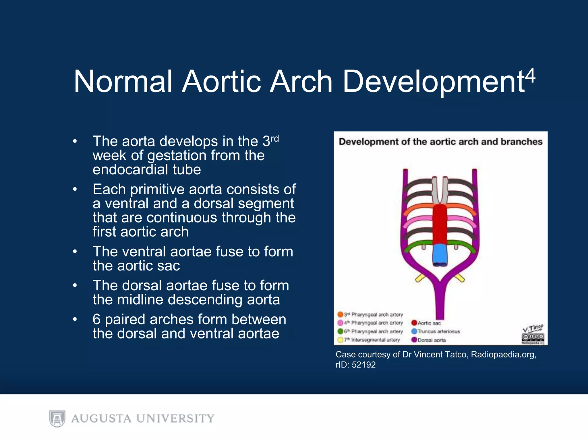 Aortic Arches A REVIEW E POSTER | PPTX