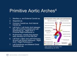 Aortic Arches A REVIEW E POSTER | PPT