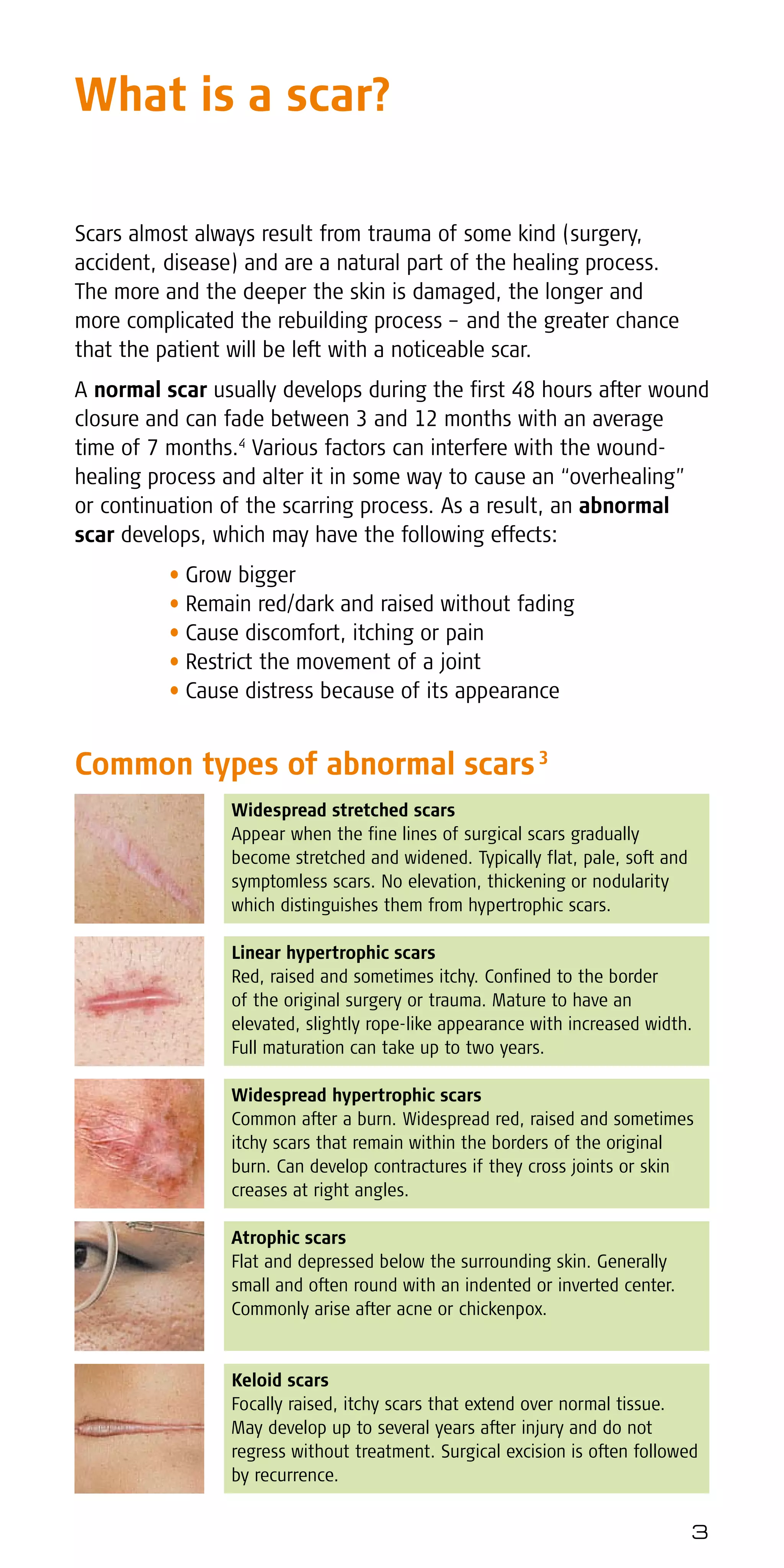 Strataderm - scar treatment and prevention with silicone | PDF