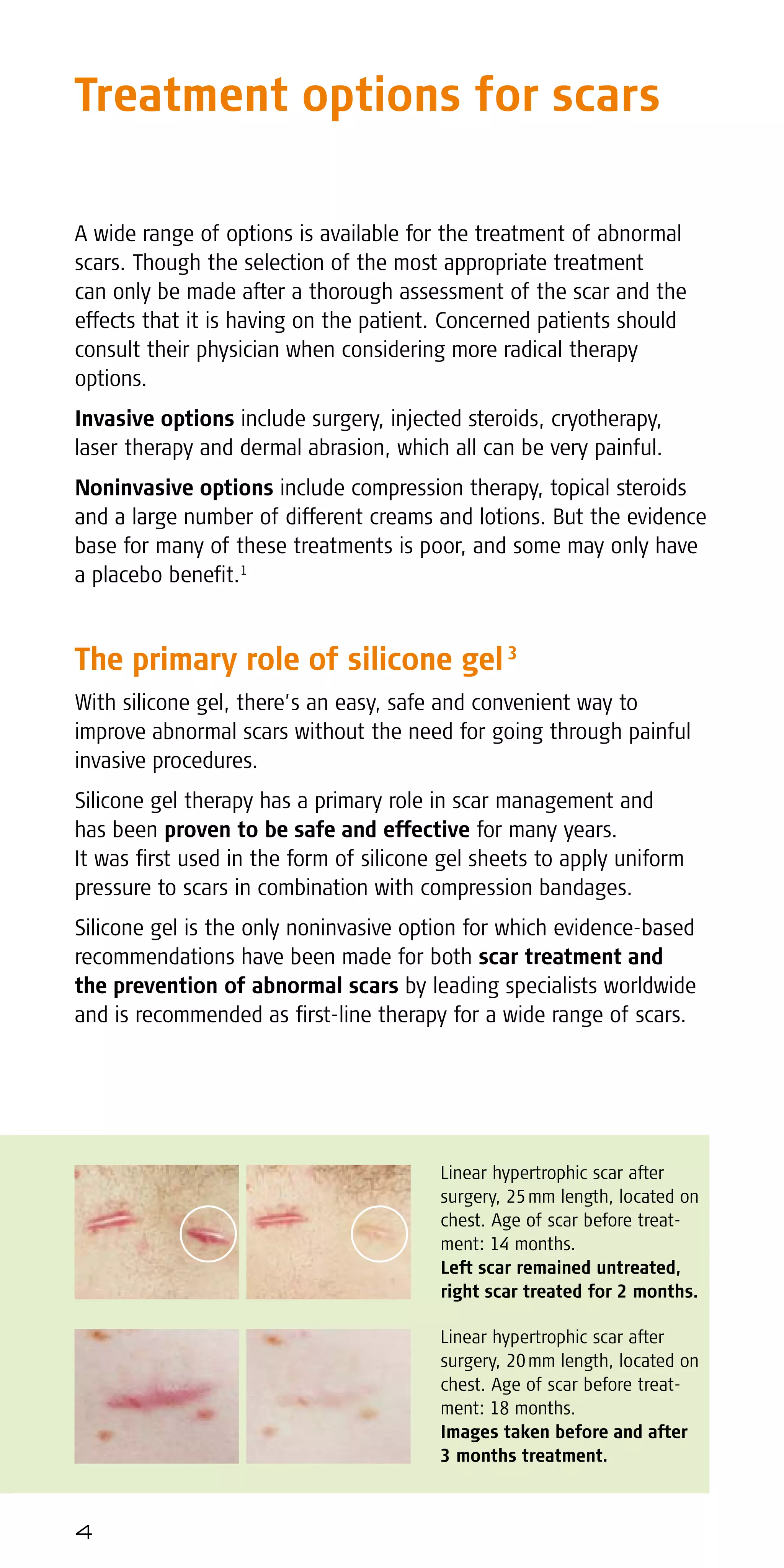 Strataderm - scar treatment and prevention with silicone | PDF