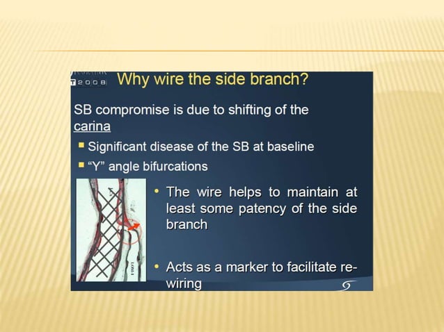 Strategies of handling side branch during pci | PPTX | Heart and ...