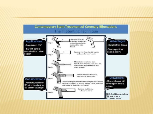 Strategies of handling side branch during pci | PPTX | Heart and ...