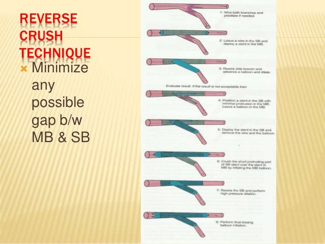 Strategies of handling side branch during pci