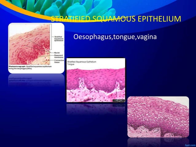 stratified EPITHELIUM HISTOLOGY lecture (1).pptx | Skin and Dermatology | Diseases and Conditions