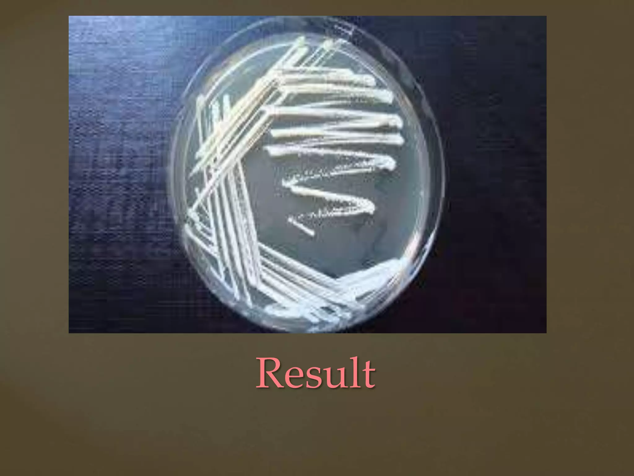 The Streak plate method, | PPTX