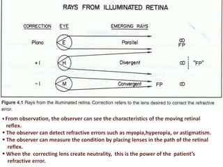 Streak retinoscope | PPTX