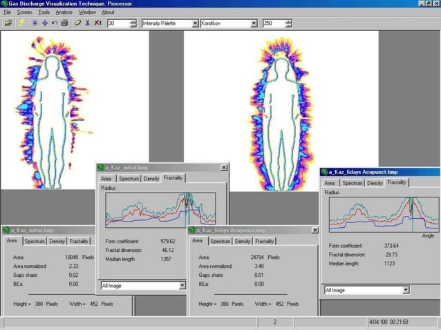 Journey into the anatomy and physiology of the human biofield with the ...
