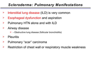 Scleroderma: State of the Art Management | PPT