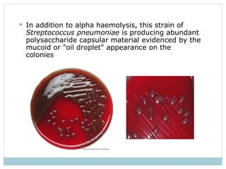 Streptococcus Pneumoniae Colony Morphology
