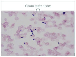 Streptococcus Salivarius Gram Stain