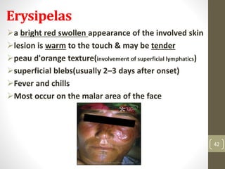 Streptococcal infections | PPSX