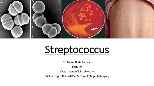 Streptococci | PPTX | Infectious Diseases | Diseases and Conditions