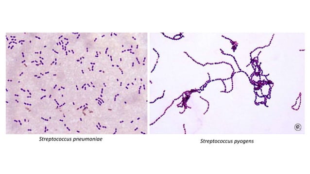 Streptococci | PPTX | Infectious Diseases | Diseases and Conditions