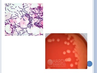 Streptococci.pdf