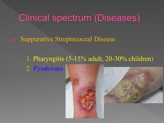 Streptococcus pyogens | PPTX