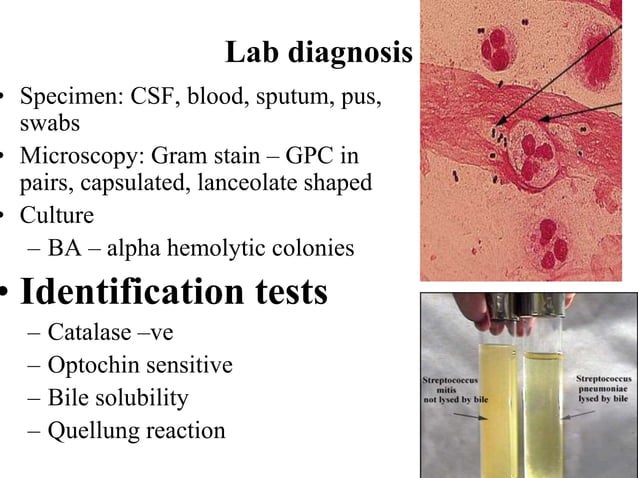 Streptococci In medical microbiology and health | PPT