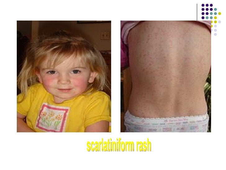 Streptococci With Pics(2)