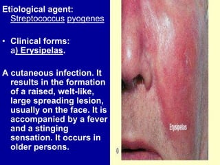 Streptococcus | PPTX