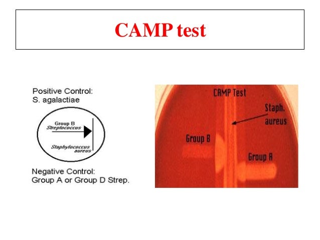 Streptococcusبكتريا عملي