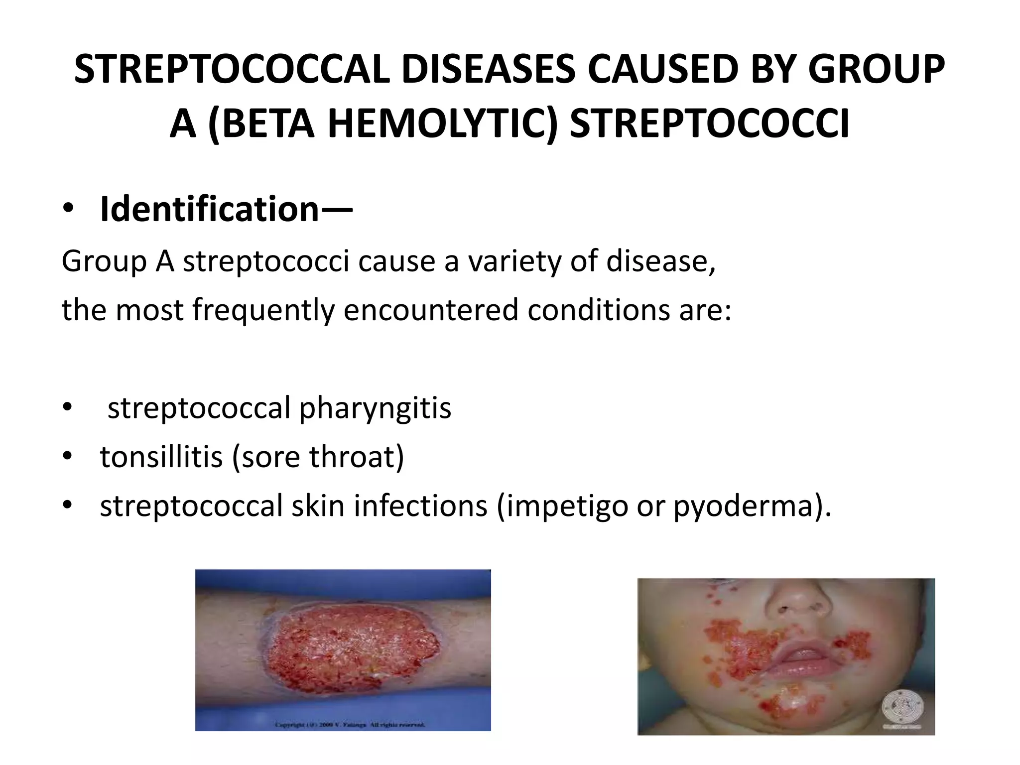 Streptococcus | PPTX