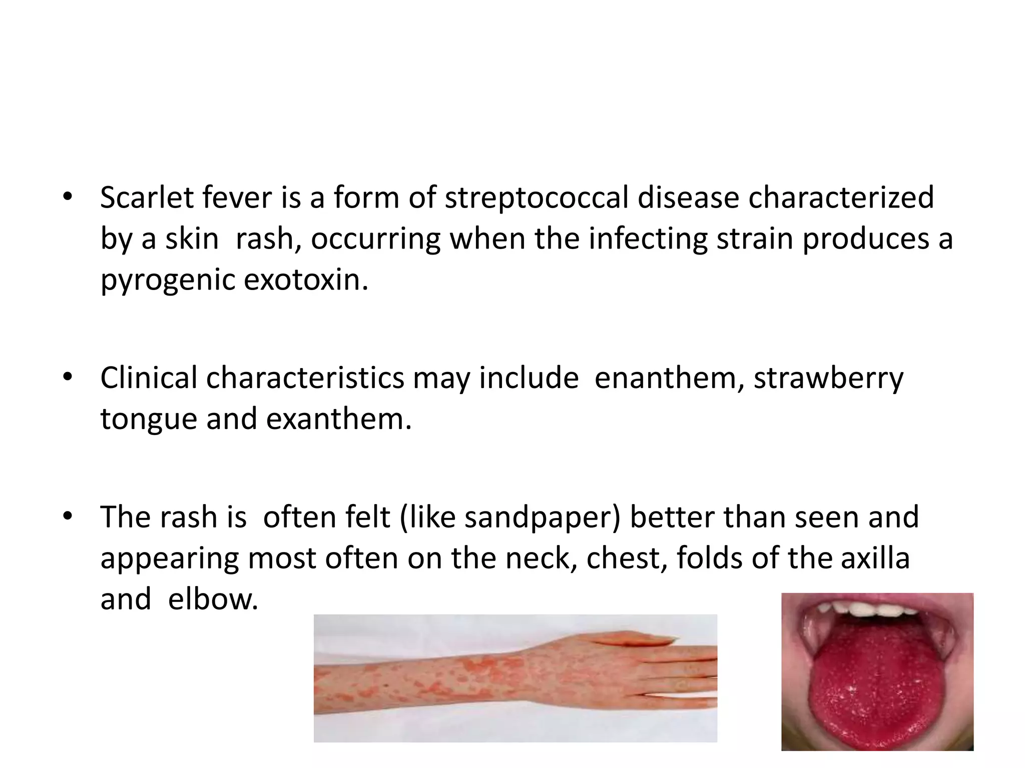 Streptococcus | PPTX | Infectious Diseases | Diseases and Conditions