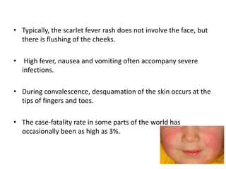 Streptococcus | PPTX | Infectious Diseases | Diseases and Conditions