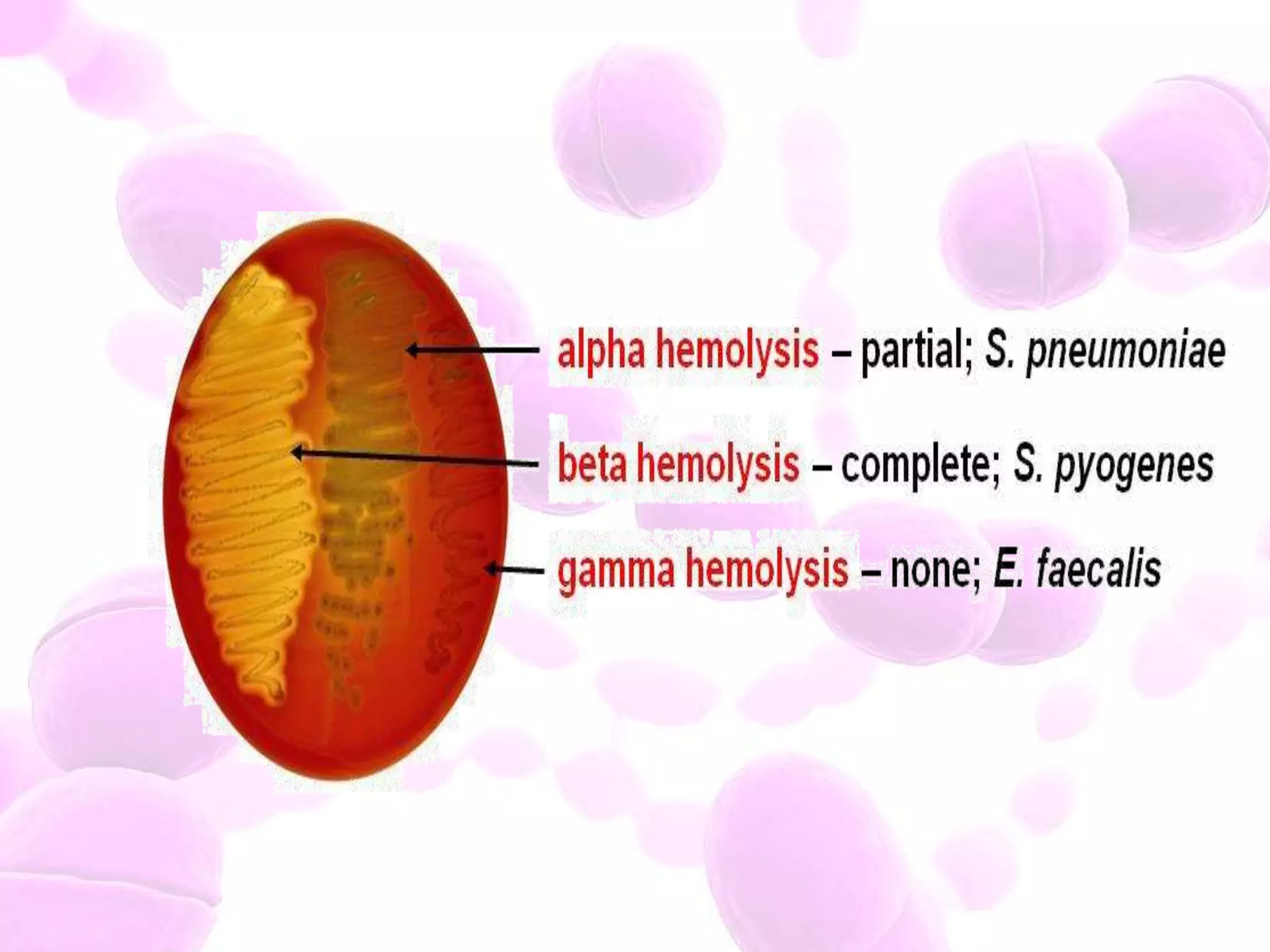 Streptococcus | PPSX
