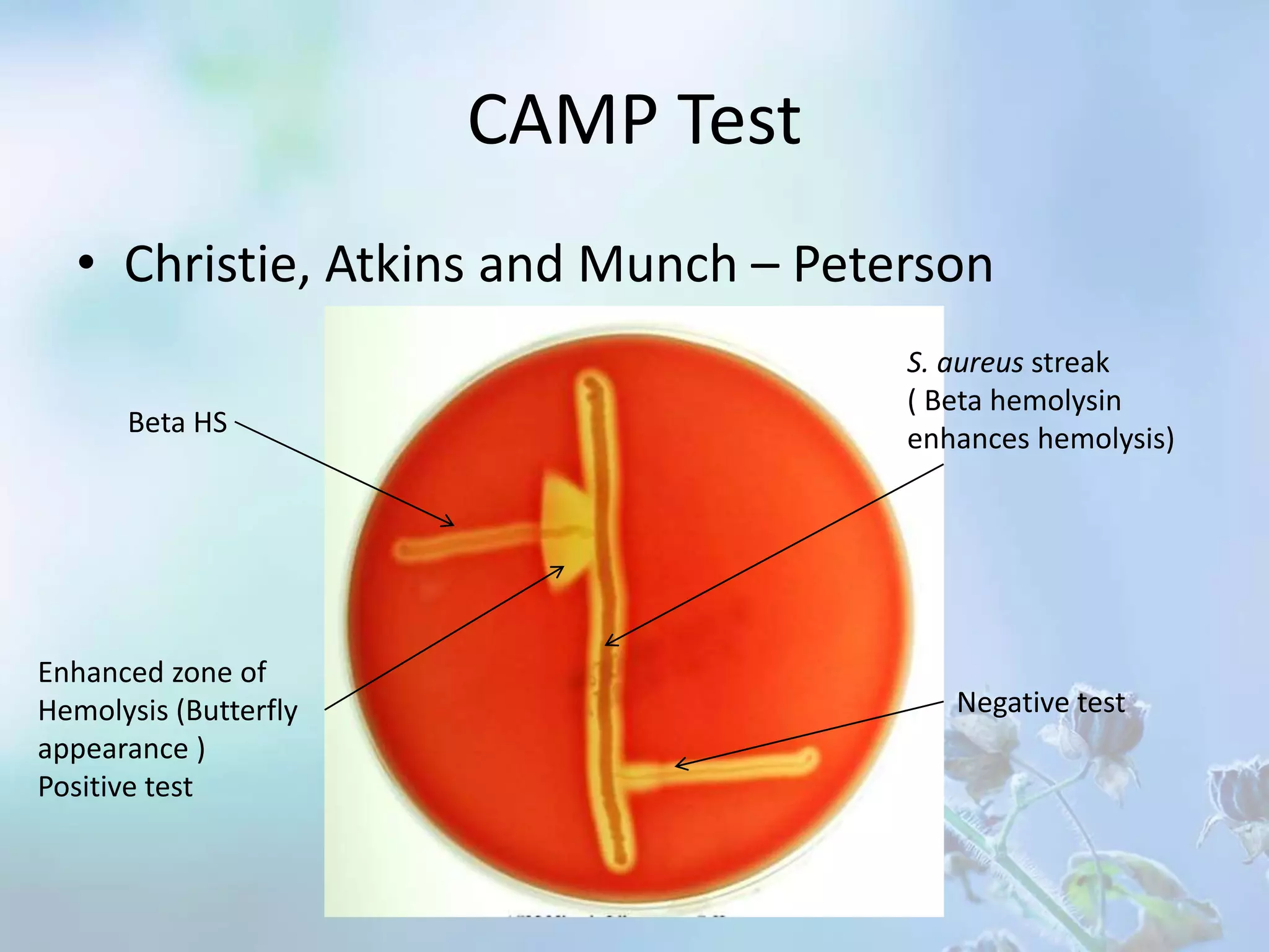 Streptococcus | PPTX