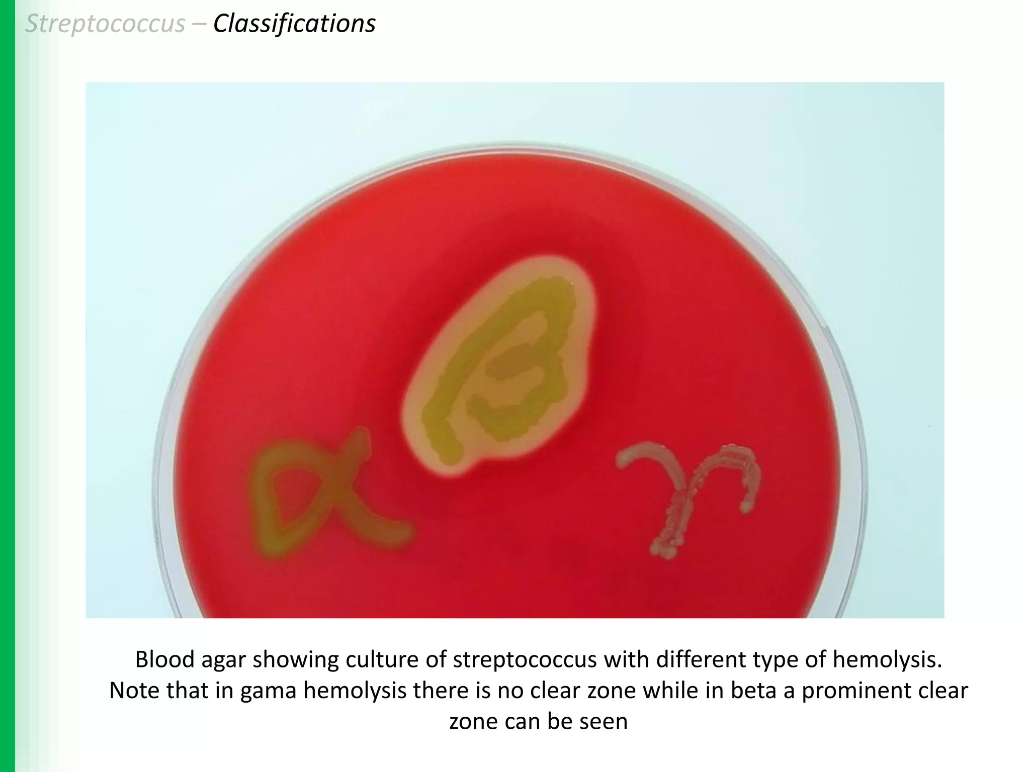 Streptococcus | PDF