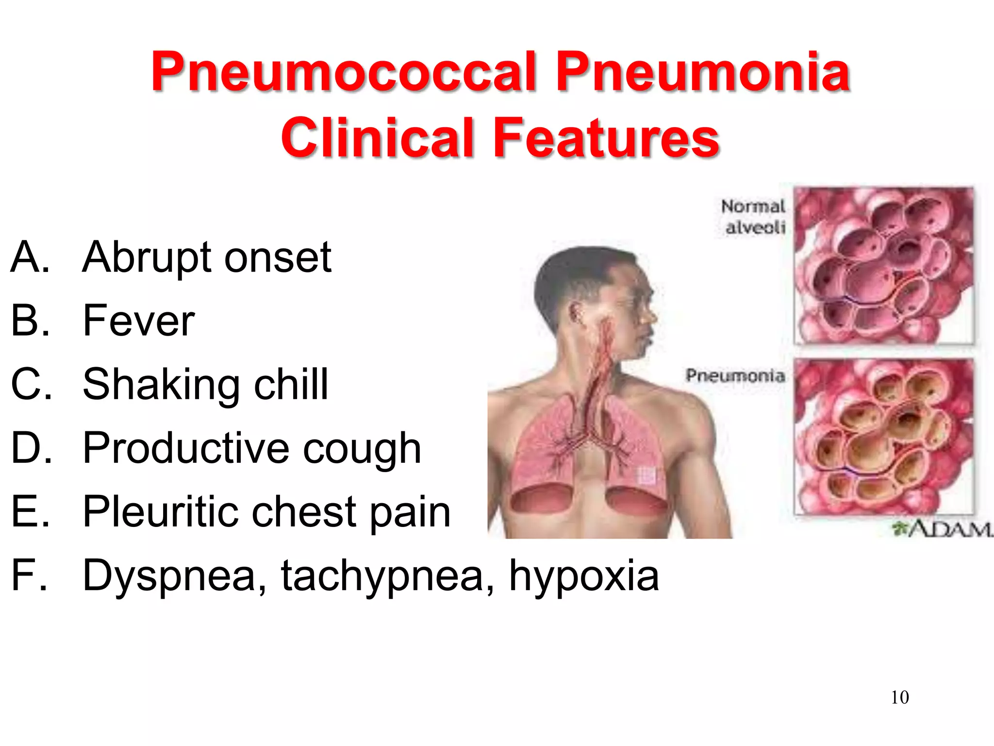 PNEUMOCOCCUS | PPT