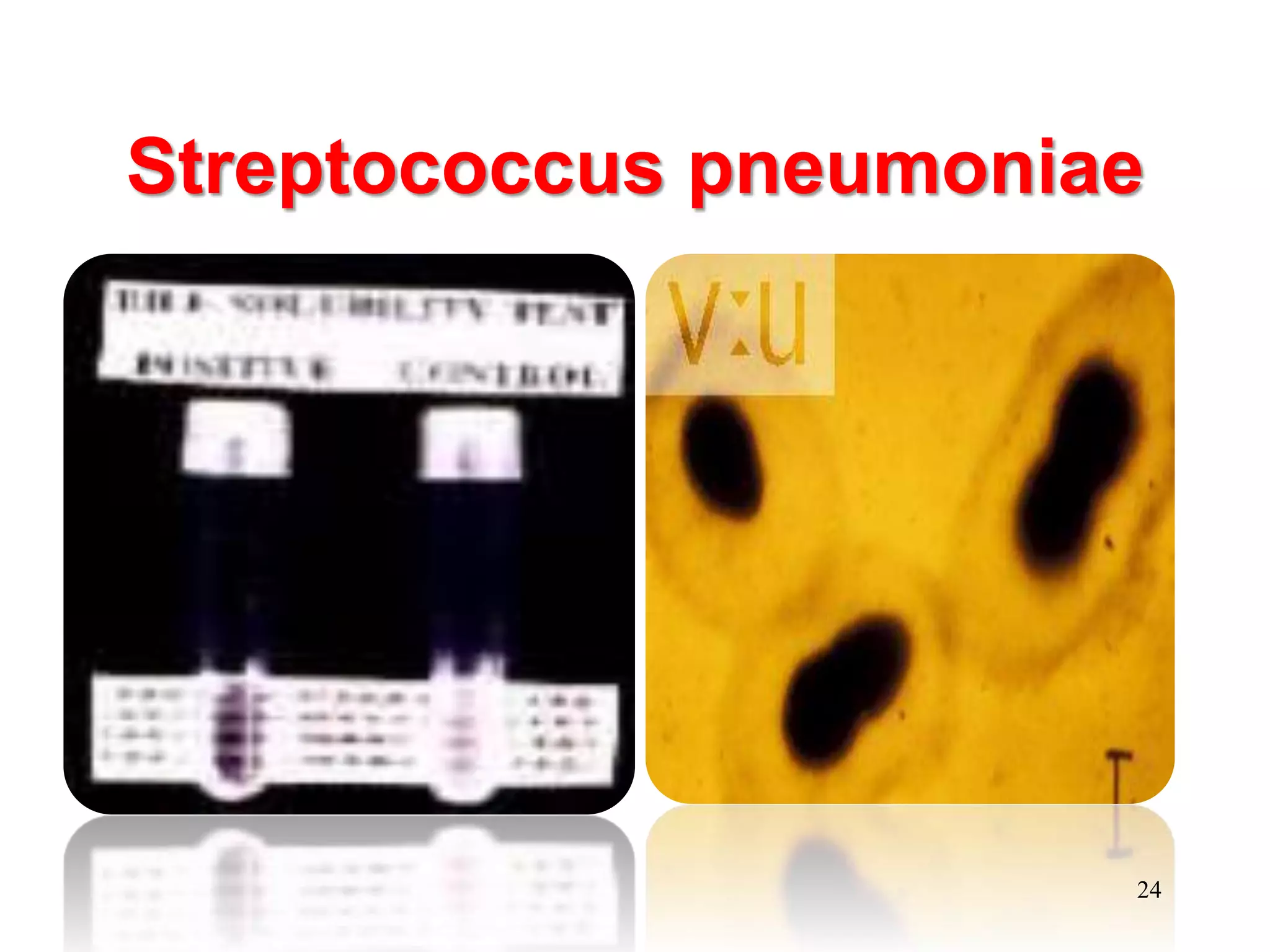 PNEUMOCOCCUS | PPT
