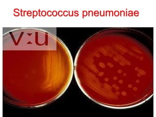 PNEUMOCOCCUS | PPT
