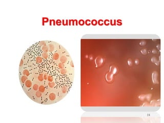 PNEUMOCOCCUS | PPT