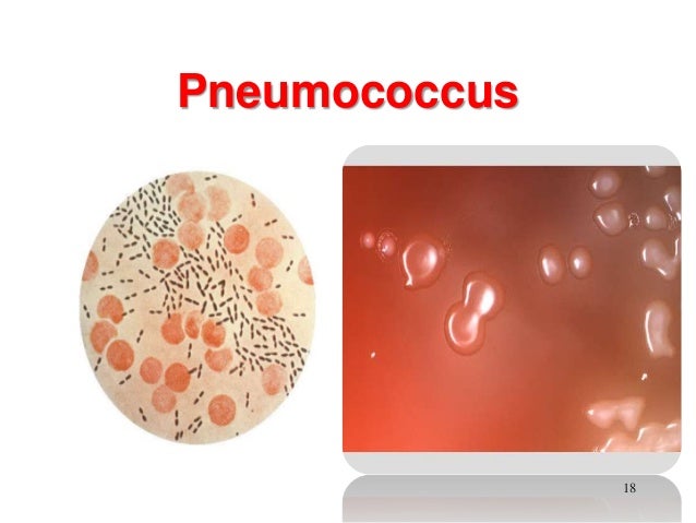 PNEUMOCOCCUS